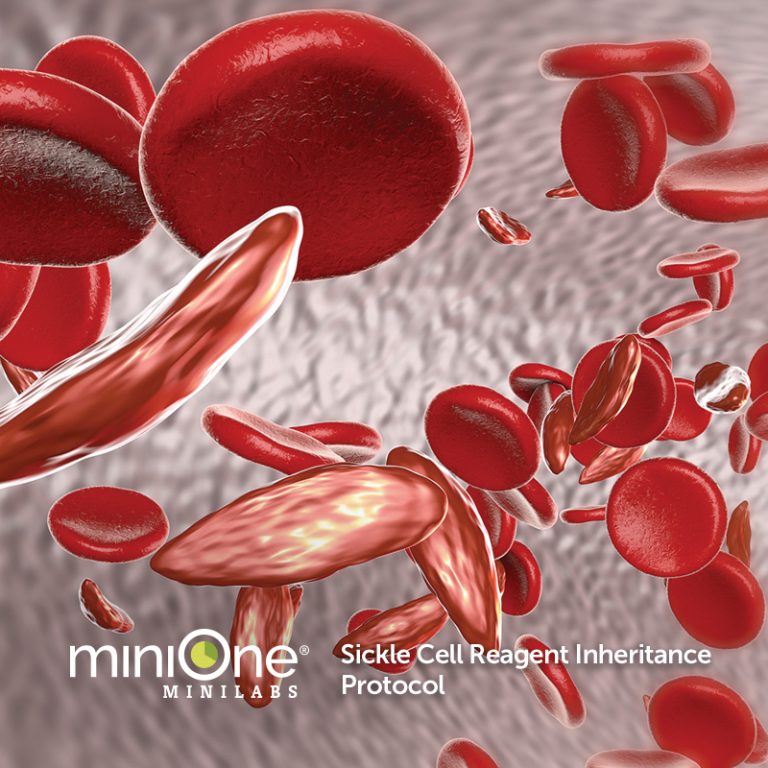 Sickle Cell MiniLab (M3050) • MiniOne Systems