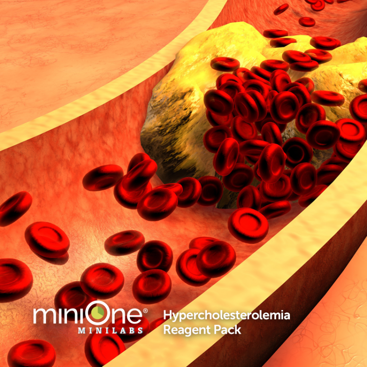 Familial Hypercholesterolemia • MiniOne Systems